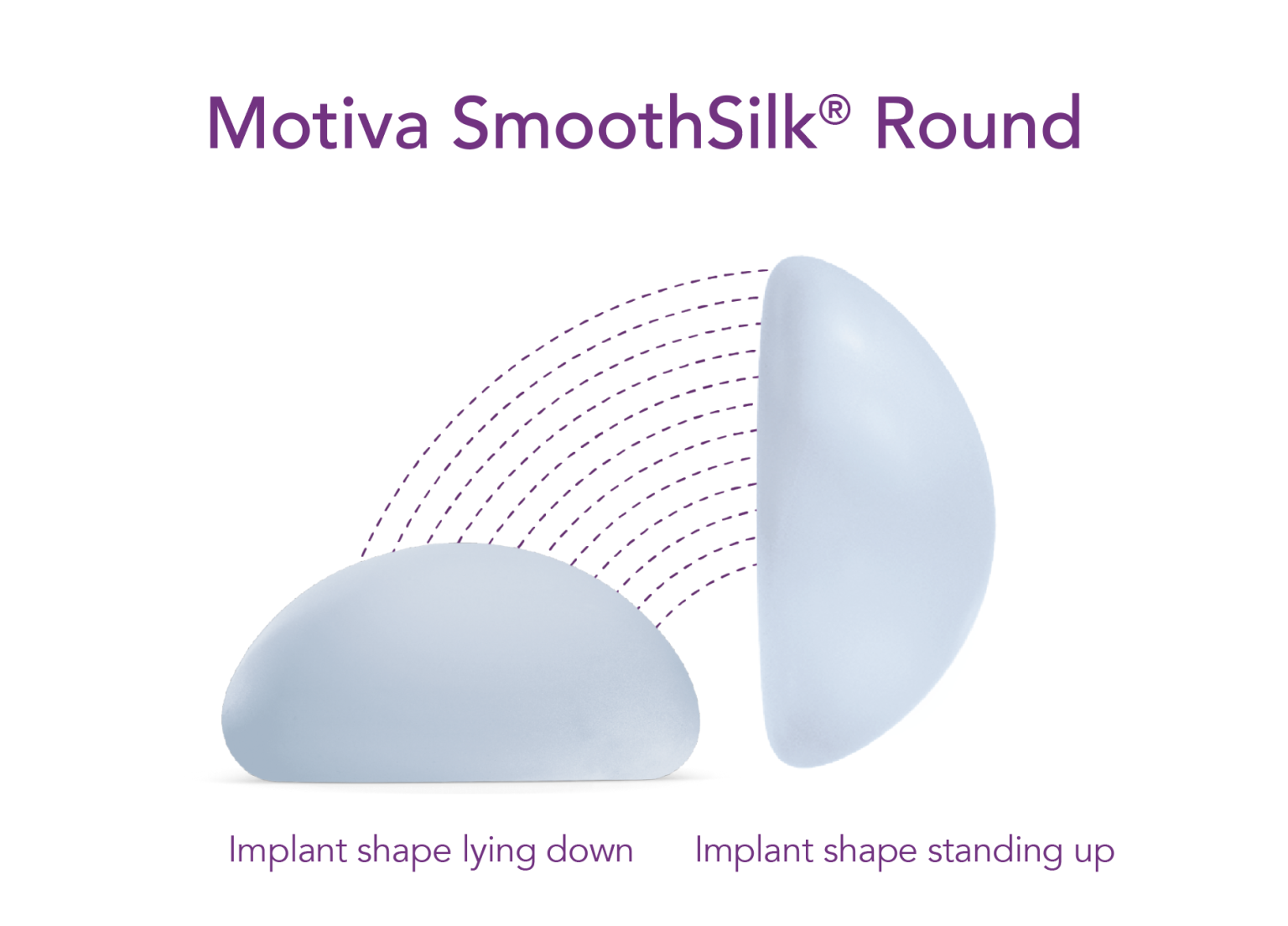 Motiva Breast Implants in Sacramento | Natural Results | Dr. Hause